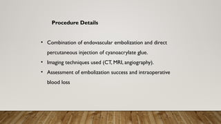 EMBOLIZATION IN JNA SURGERY. Before surgery | PPTX
