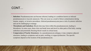 Embolization of Pseudoaneurysm slide share.pptx