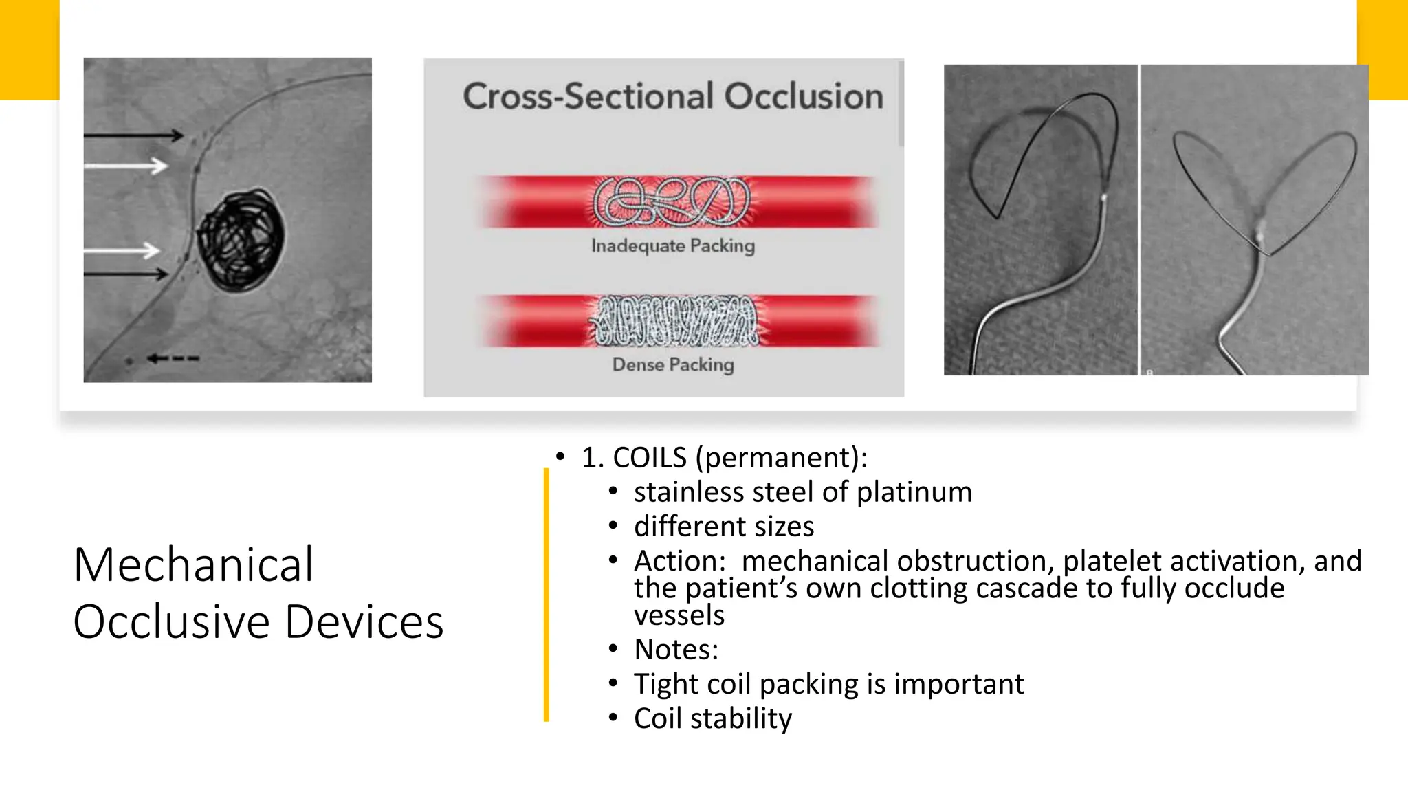 embolizing agents.pptx