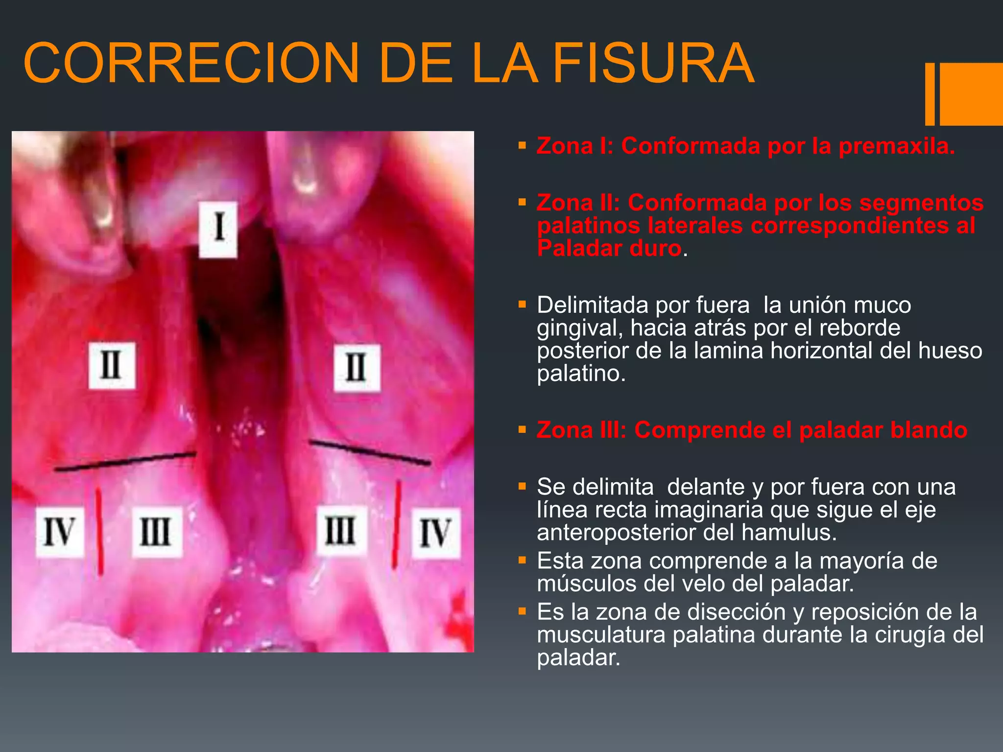 Embriologia, anatomia y clasificacion de labio y | PPTX
