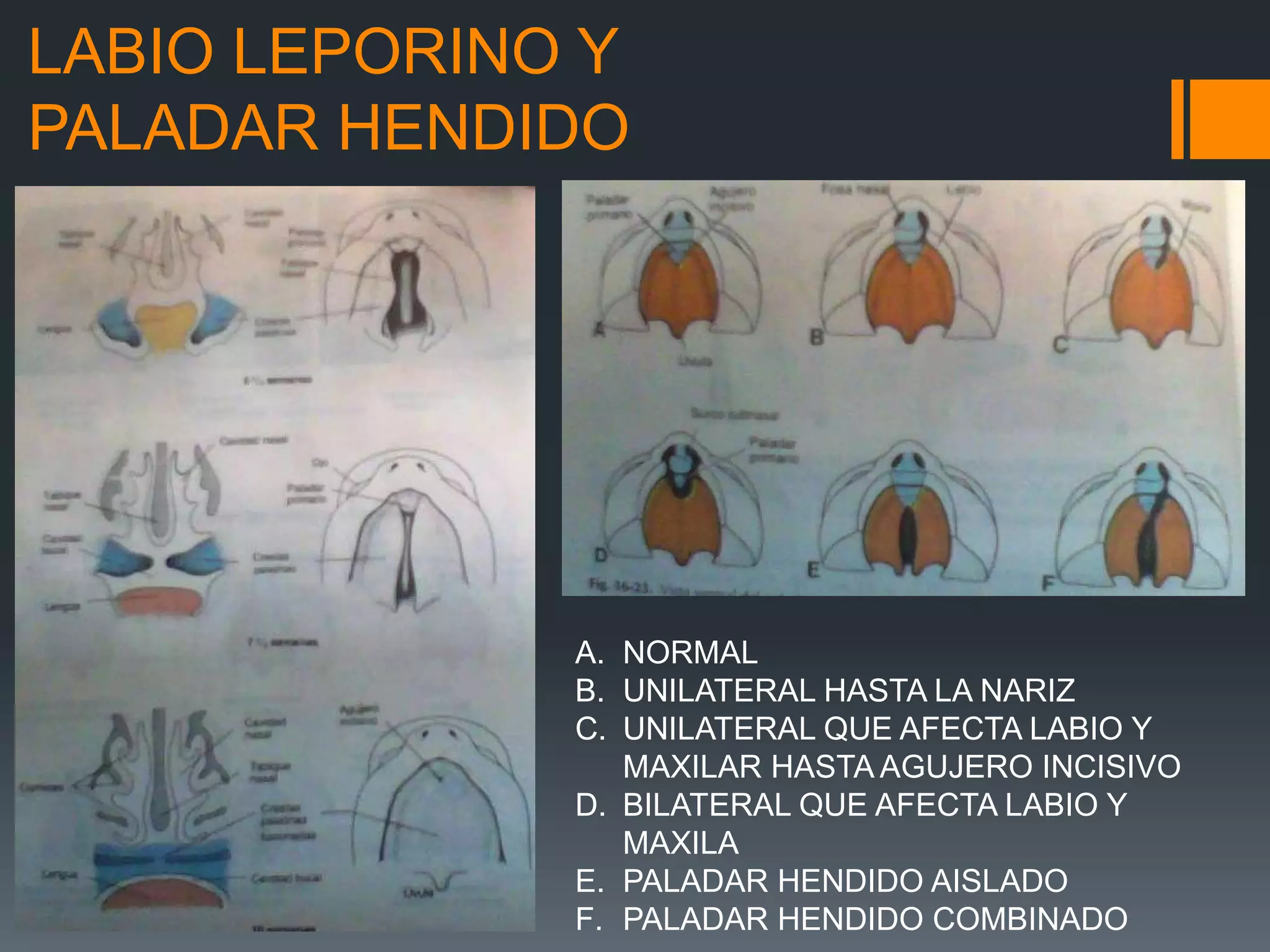 Embriologia, anatomia y clasificacion de labio y | PPTX