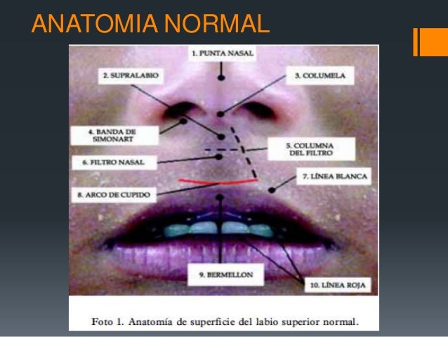 Embriologia, anatomia y clasificacion de labio y