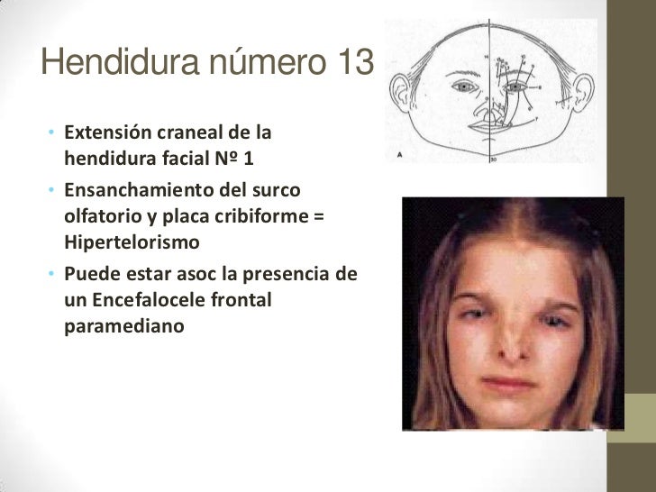 Embriologia Del Complejo Craneofacial