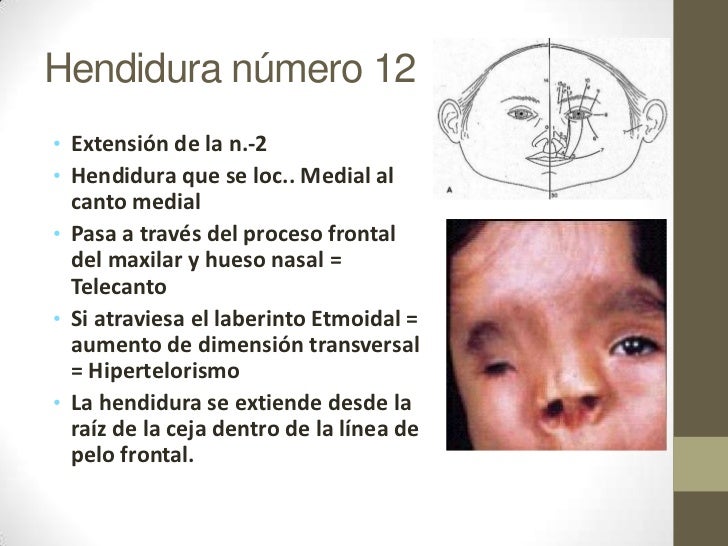 Embriologia Del Complejo Craneofacial