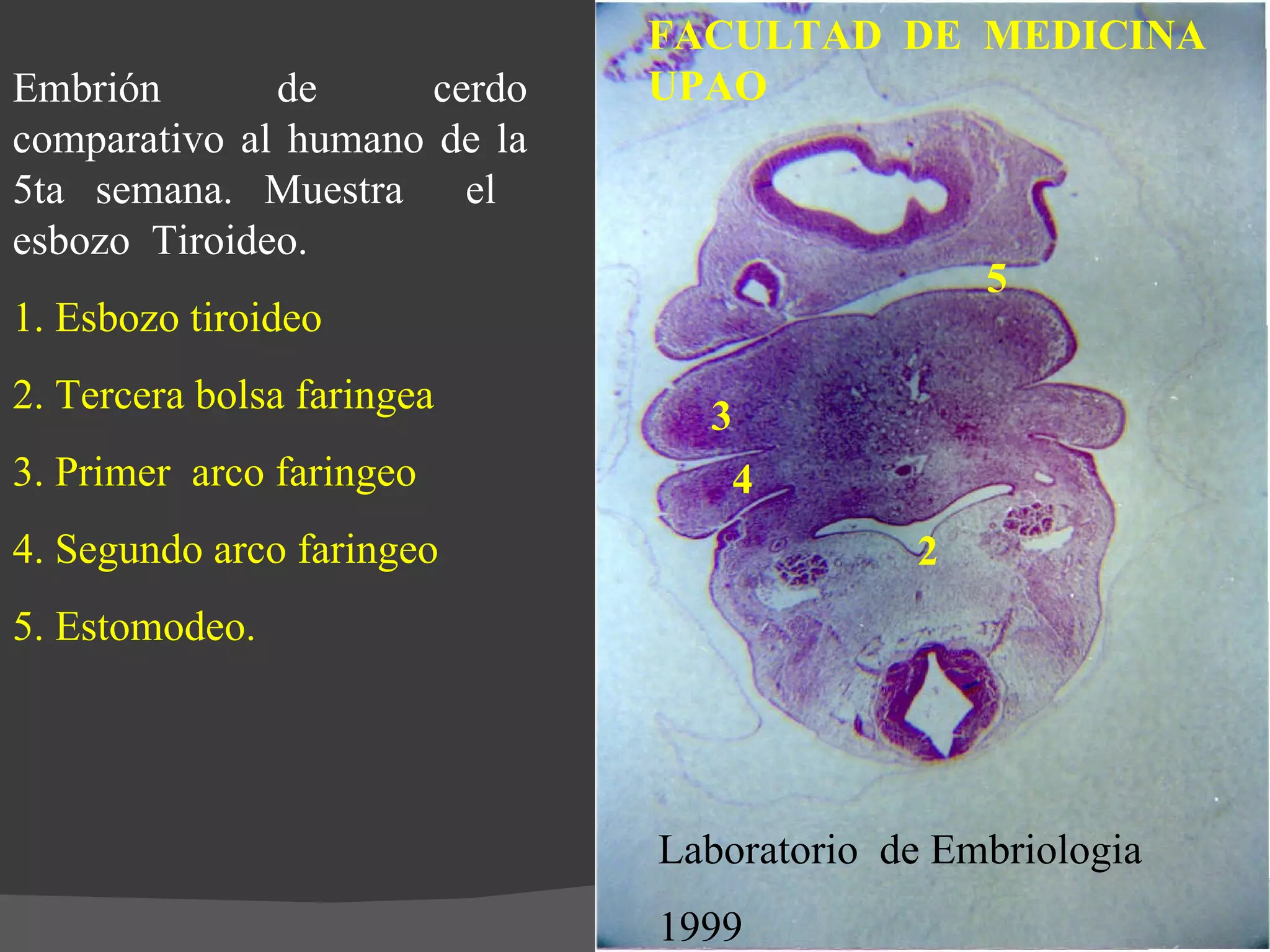 embriologia del tiroides | PPT