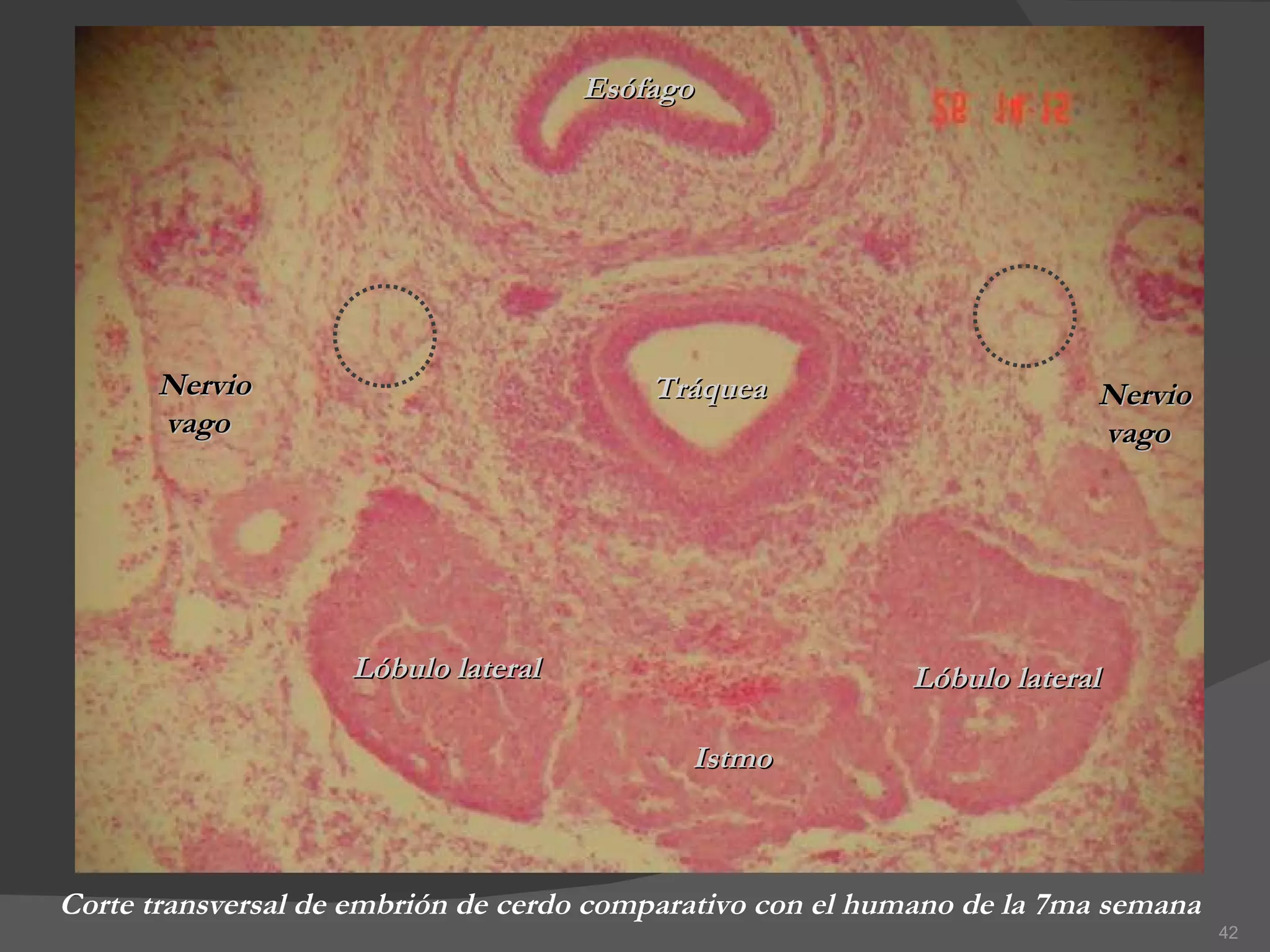 embriologia del tiroides | PPT