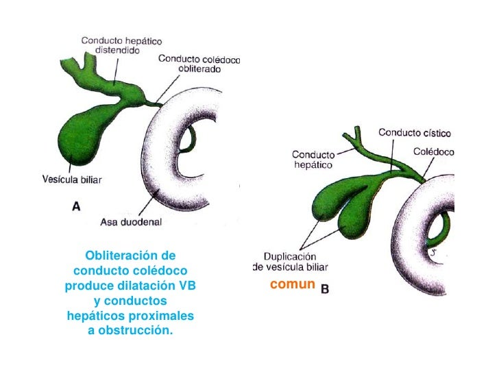 Embriologia de vias biliares