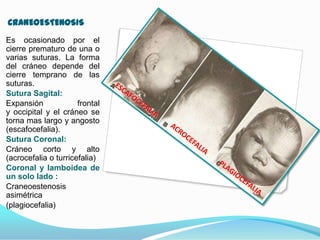 Embriologia sistema esquelético | PPTX