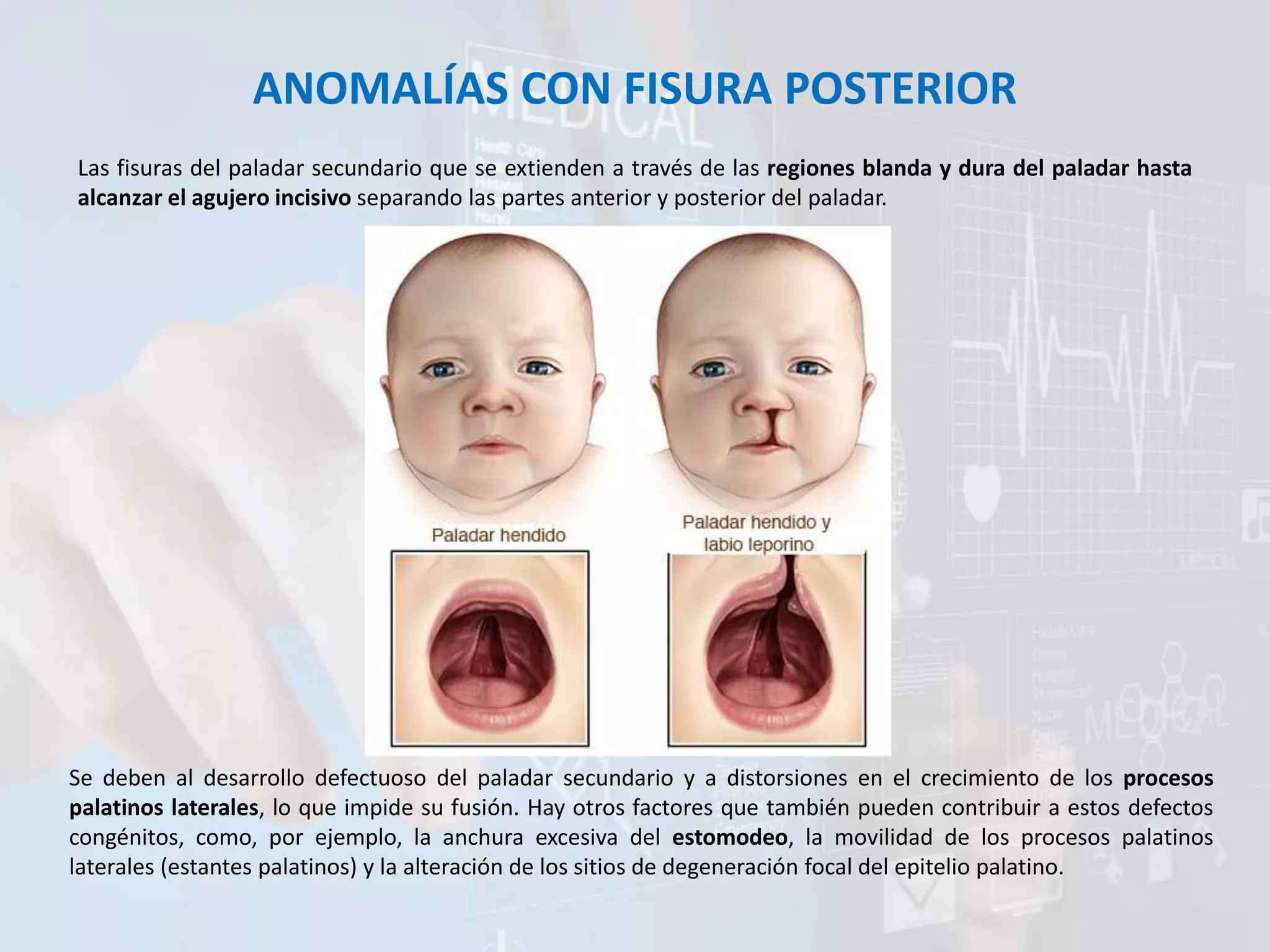 DESARROLLO EMBRIOLOGICO DE LAS CAVIDADES NASALES , DESARROLLO DEL ...