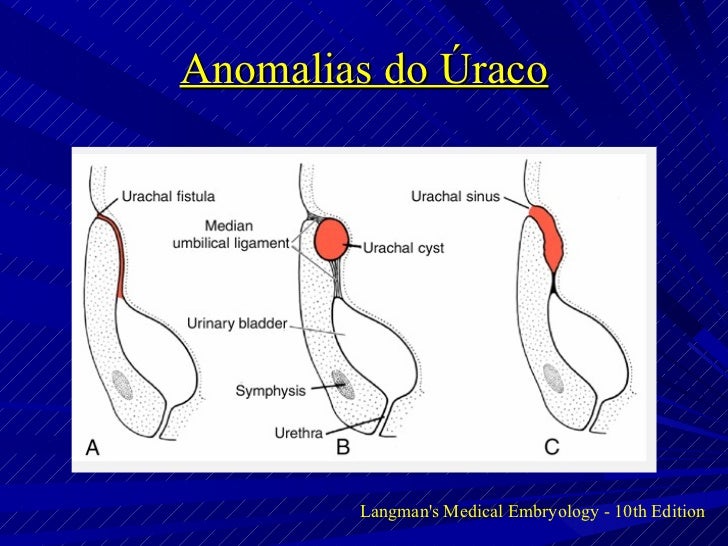 Embriologia do Trato Urinário II (genital)