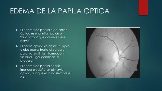 Embriologia del ojo