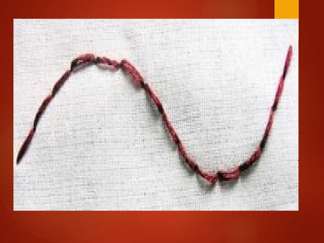 EMBROIDERY STITCHES DEFINITION.pptx emb | PPT