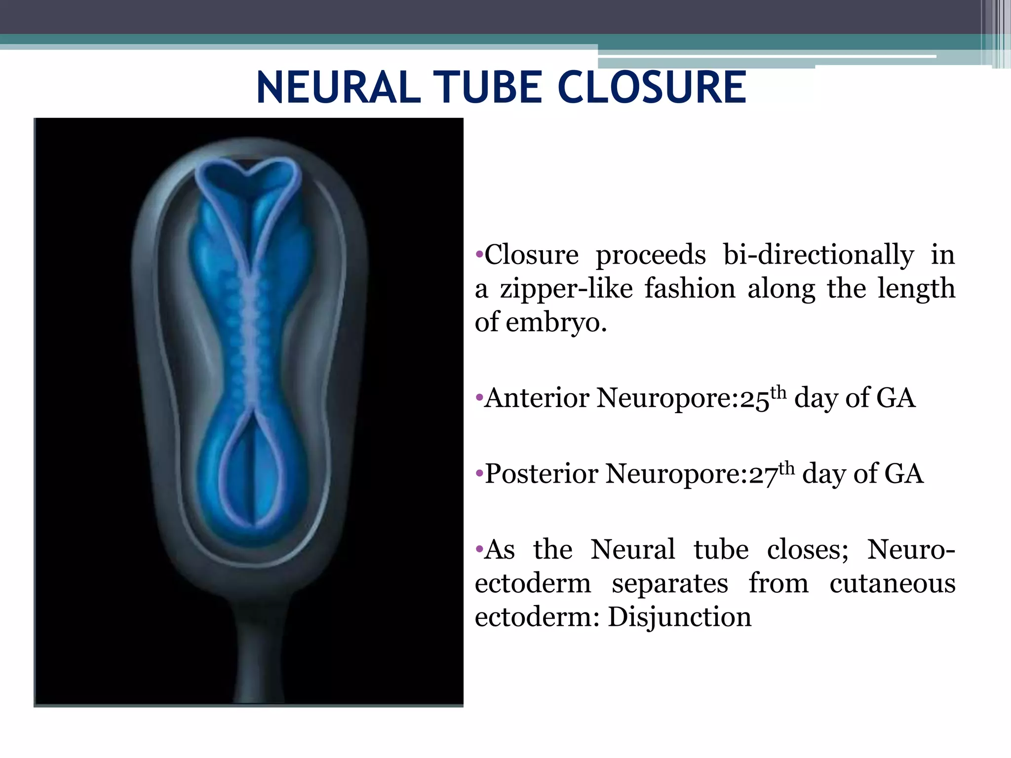 Basics of Embryology and short review of congenital errors of CNS in ...