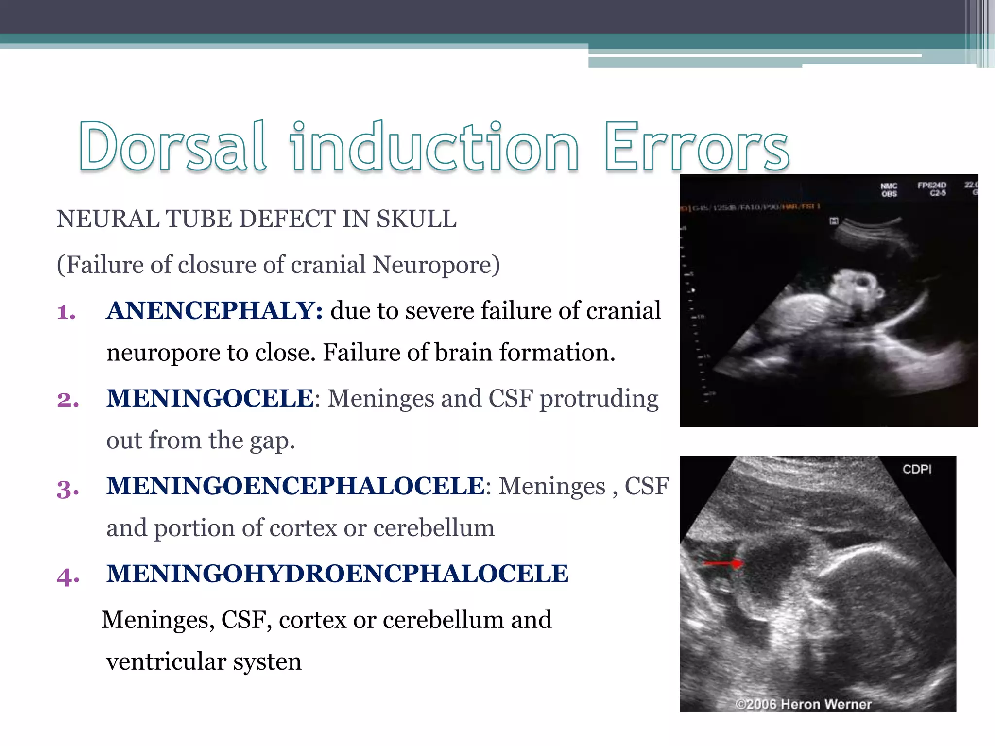 Basics of Embryology and short review of congenital errors of CNS in ...