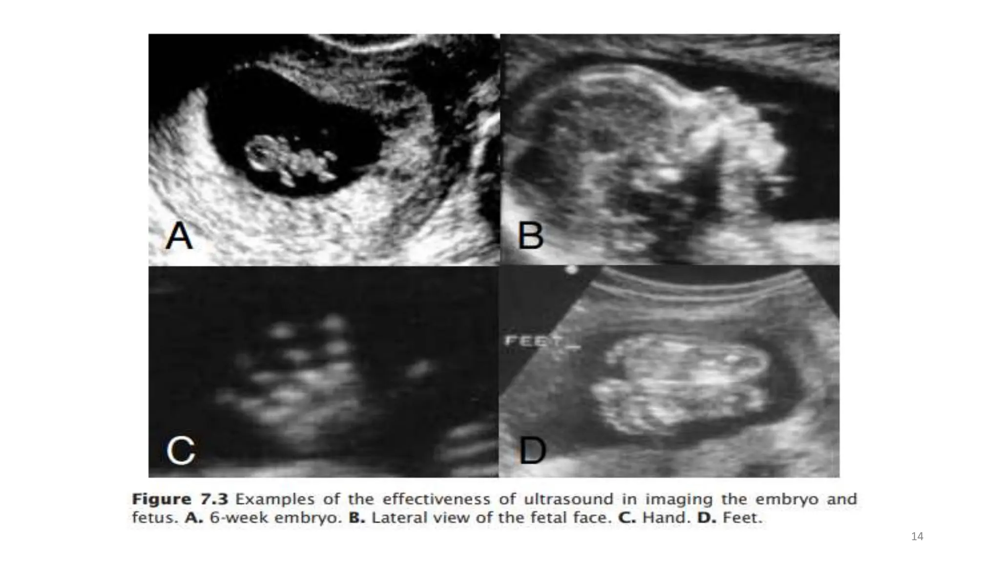 diagnosis and tests of embryo and fetus : prenatal diagnosis | PPT