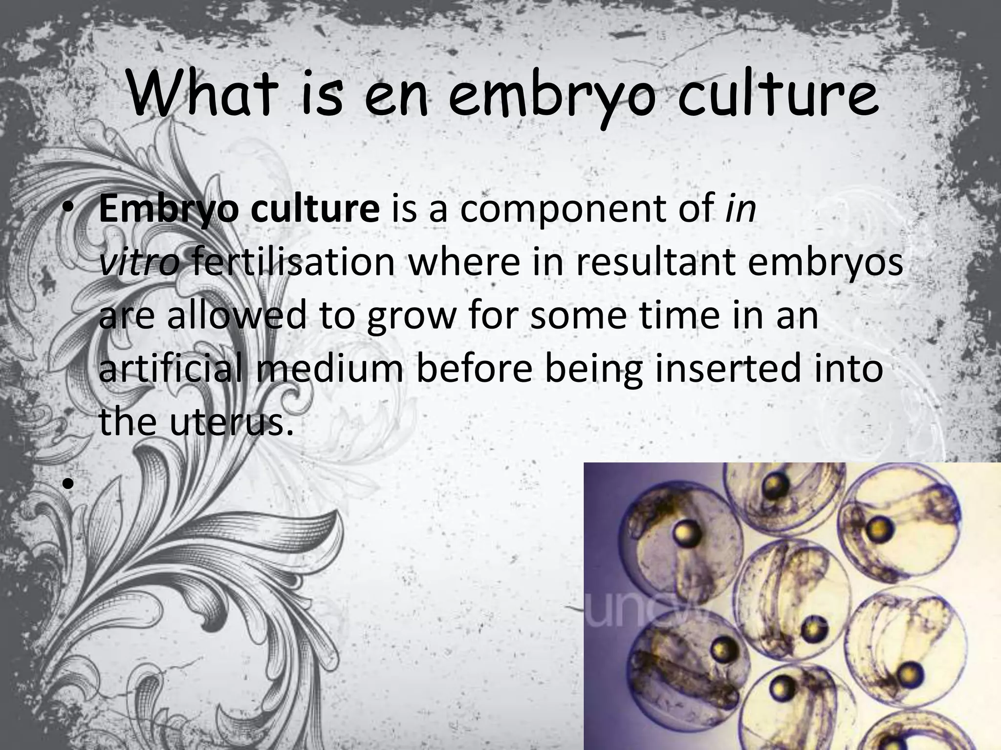 Embryo culture | PPTX