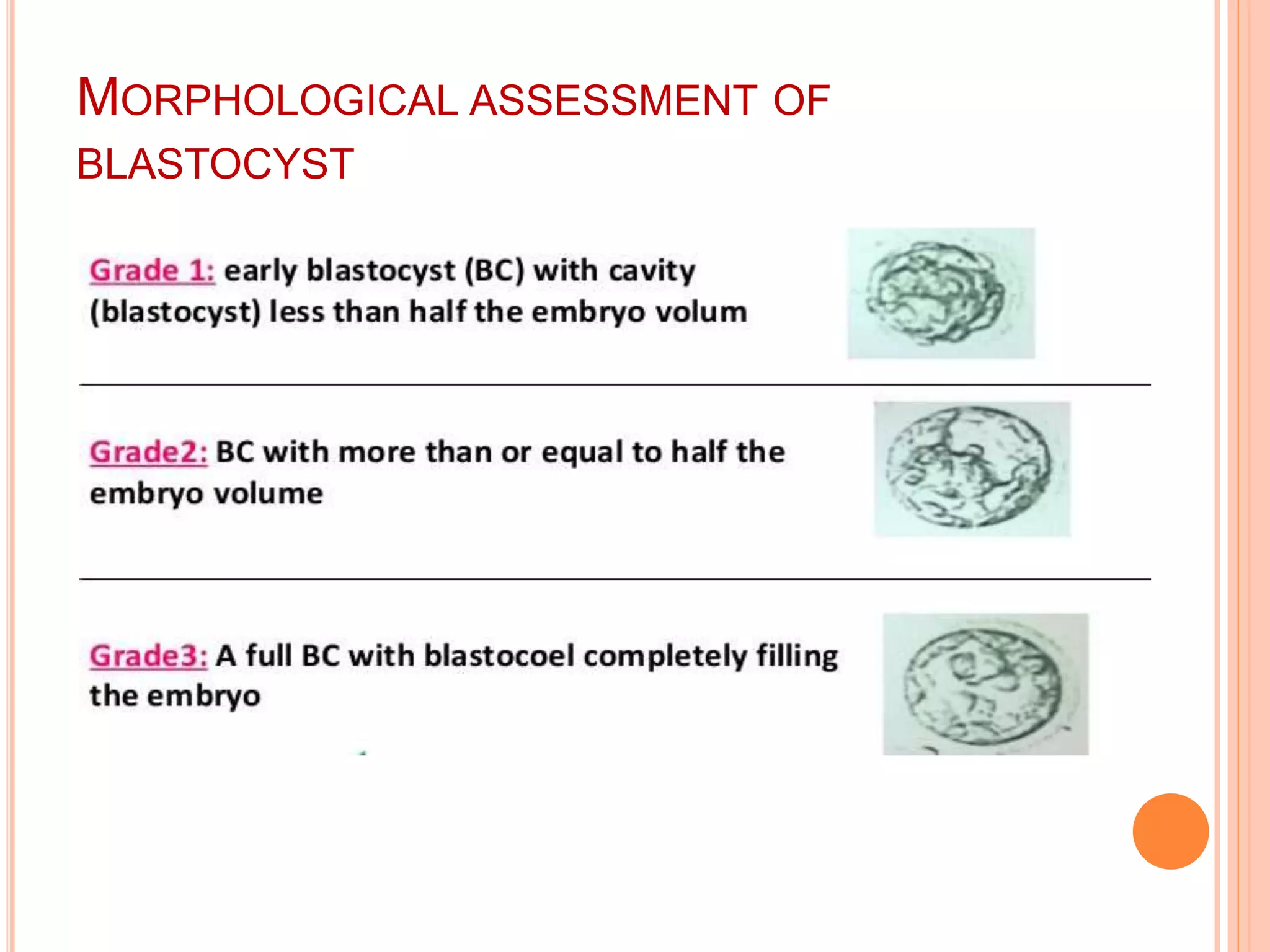 Embryo grading | PPTX
