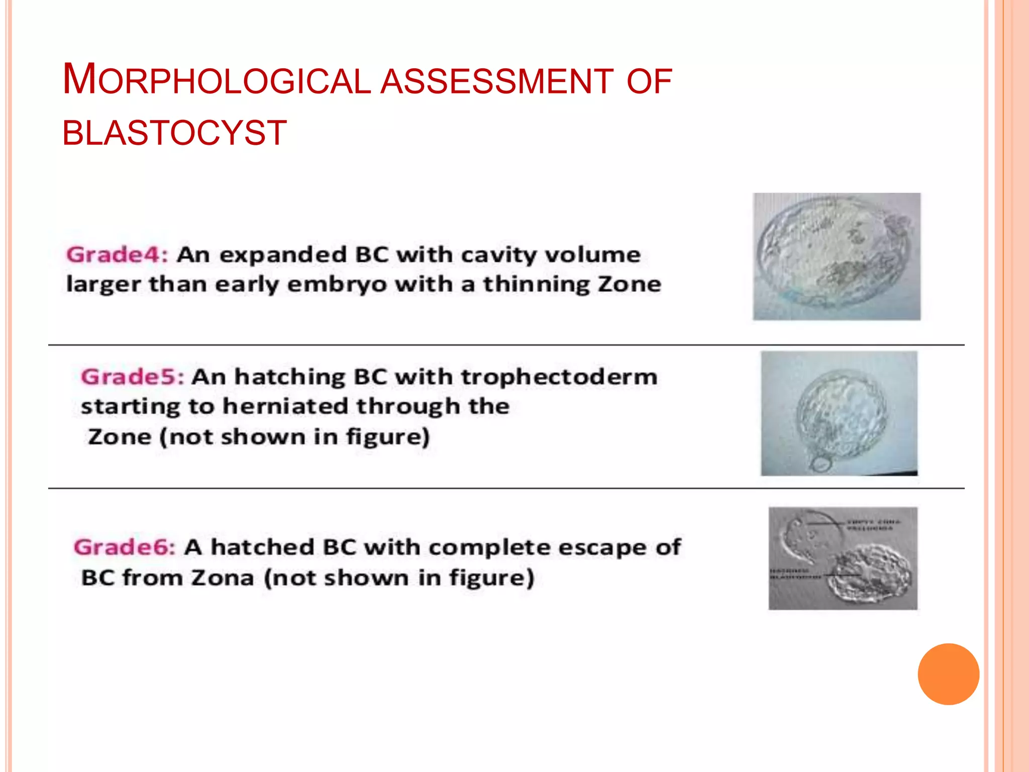 Embryo grading | PPTX
