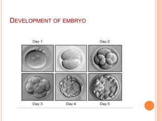 Embryo grading | PPTX