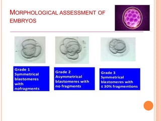 Embryo grading | PPTX