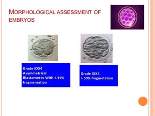 Embryo grading | PPTX