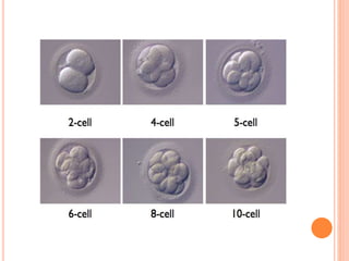 Embryo grading | PPTX