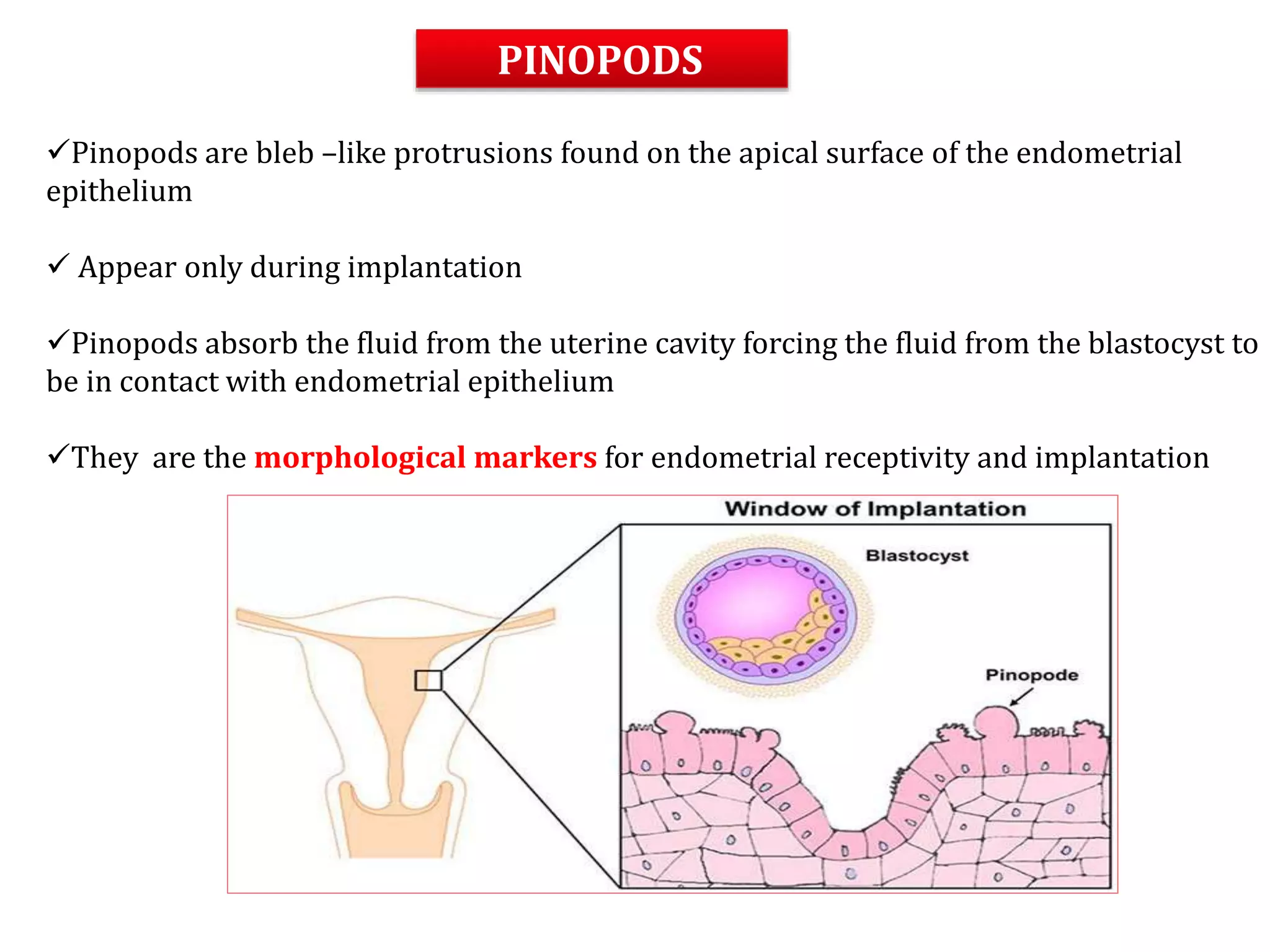 embryo implantation failure.pptx