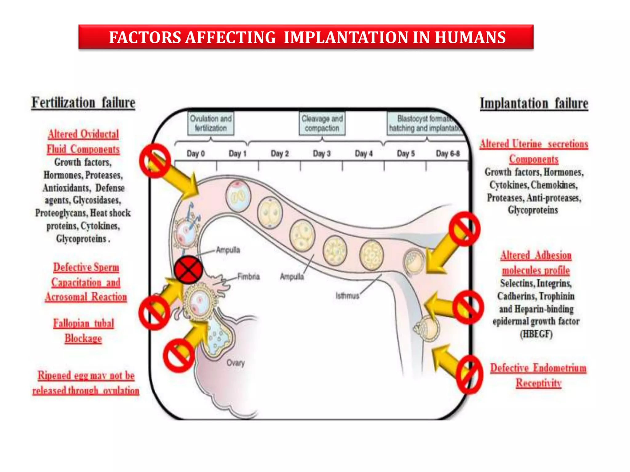 embryo implantation failure.pptx