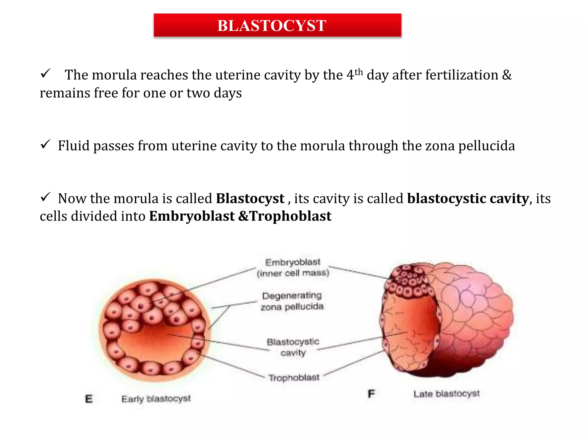 embryo implantation failure.pptx