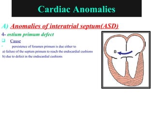 Embryological basis of congenital heart diseases | PPT