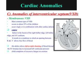 Embryological basis of congenital heart diseases | PPT