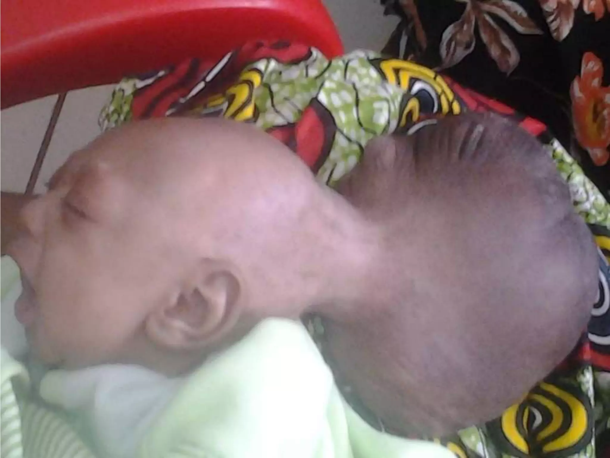 Embryological development of the nervous system and special | PPTX