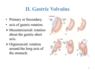 Embryologic basis of GIT malformation | PPTX