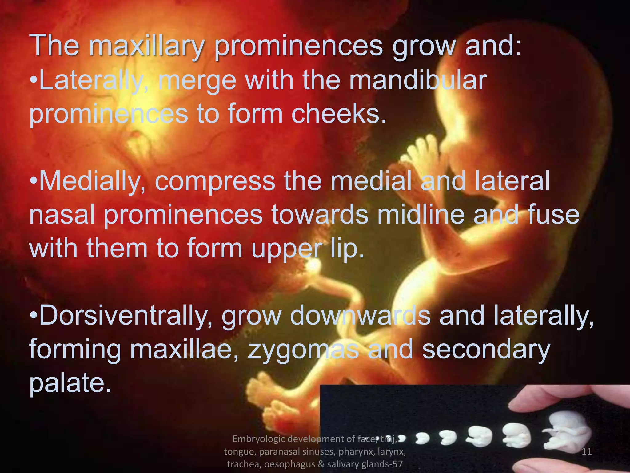 Embryology of face, tmj, tongue, paranasal sinuses, pharynx, larynx ...