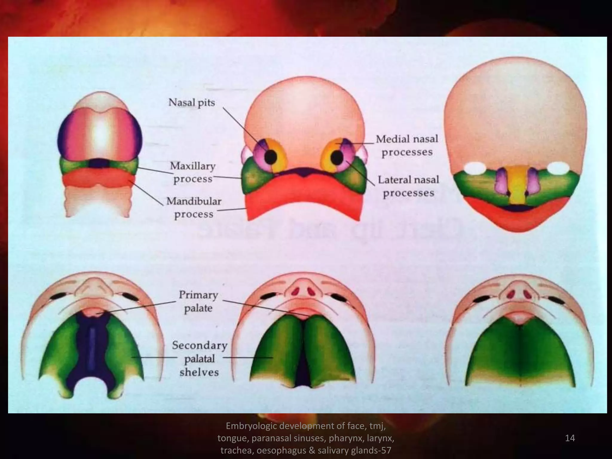 Embryology of face, tmj, tongue, paranasal sinuses, pharynx, larynx ...
