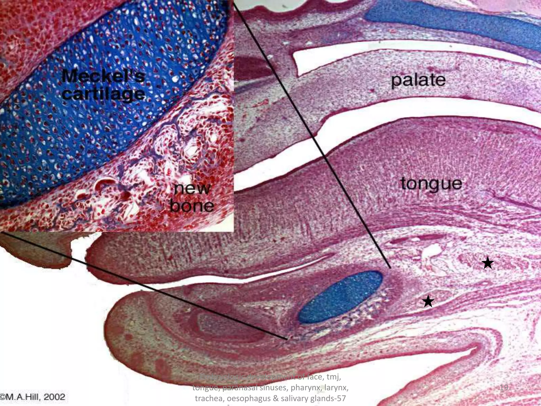 Embryology of face, tmj, tongue, paranasal sinuses, pharynx, larynx ...