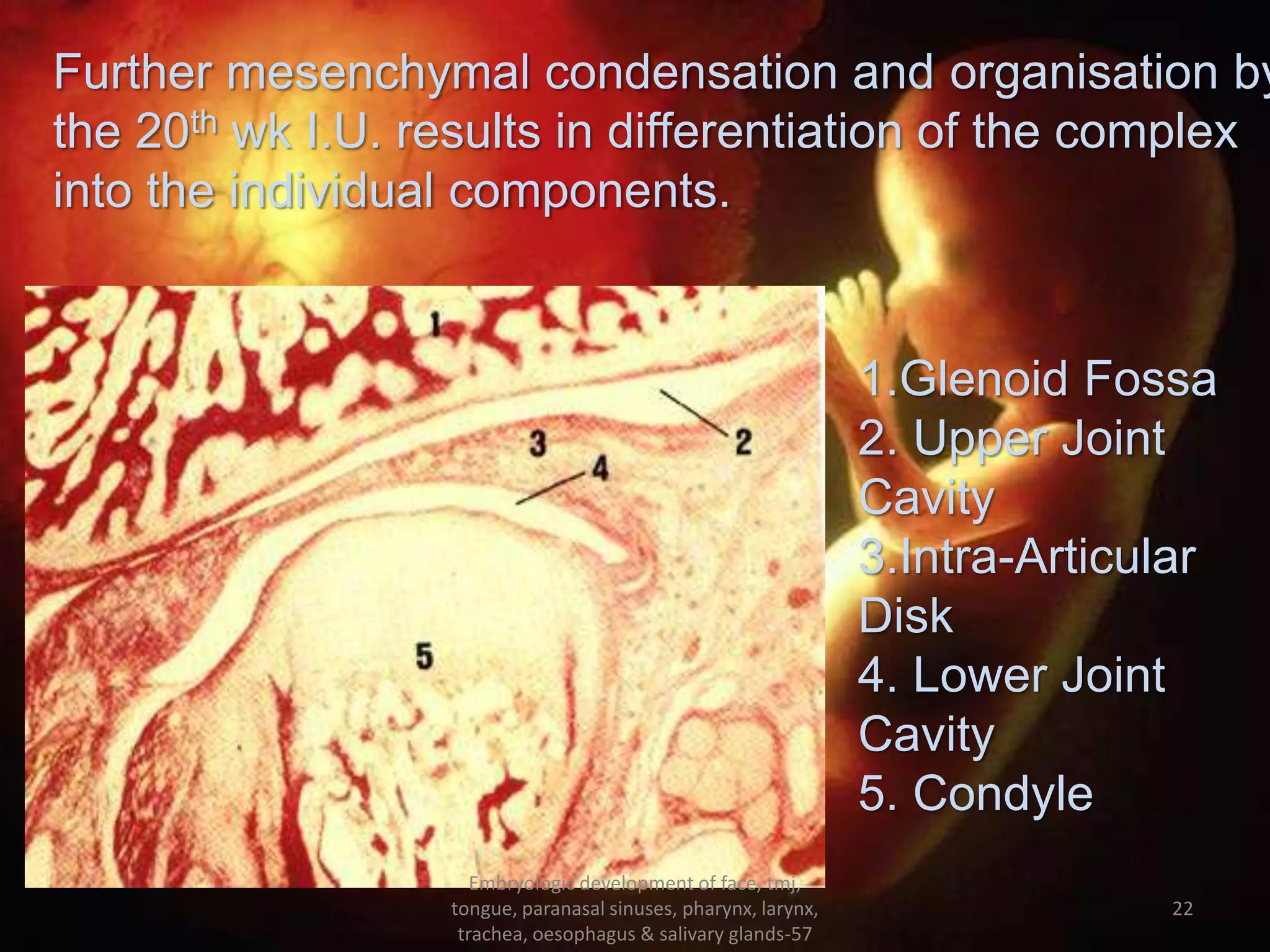 Embryology of face, tmj, tongue, paranasal sinuses, pharynx, larynx ...