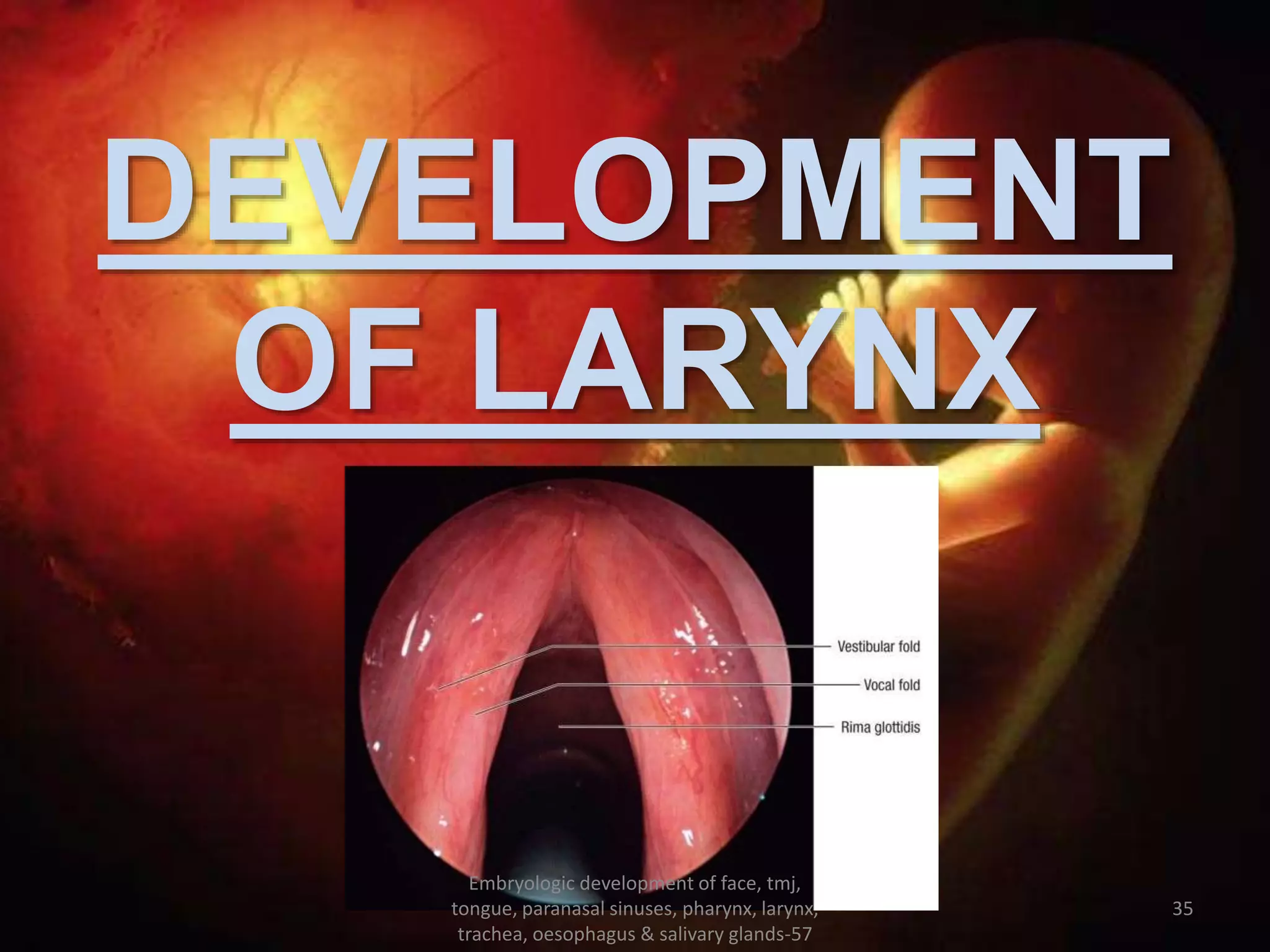 Embryology of face, tmj, tongue, paranasal sinuses, pharynx, larynx ...