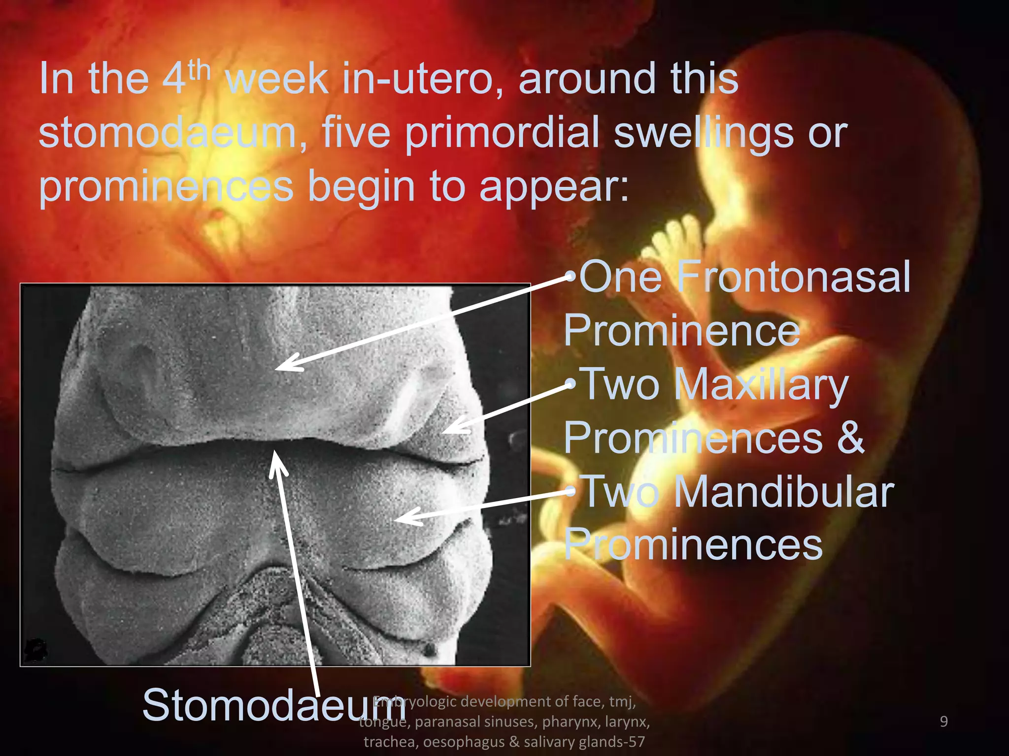 Embryology of face, tmj, tongue, paranasal sinuses, pharynx, larynx ...