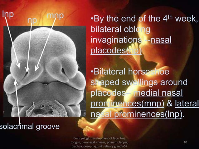 Embryology of face, tmj, tongue, paranasal sinuses, pharynx, larynx ...
