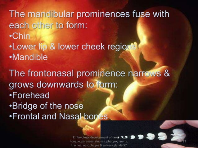 Embryology of face, tmj, tongue, paranasal sinuses, pharynx, larynx ...