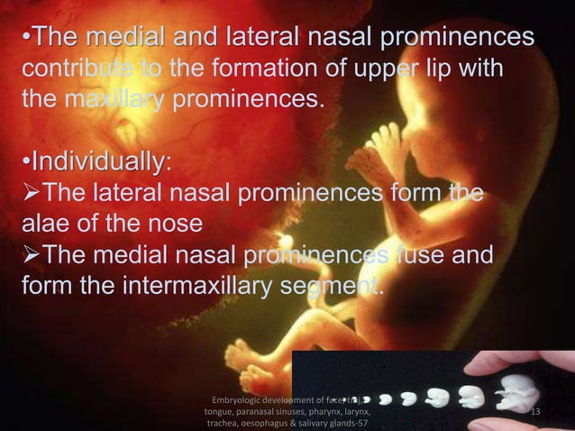 Embryology of face, tmj, tongue, paranasal sinuses, pharynx, larynx ...
