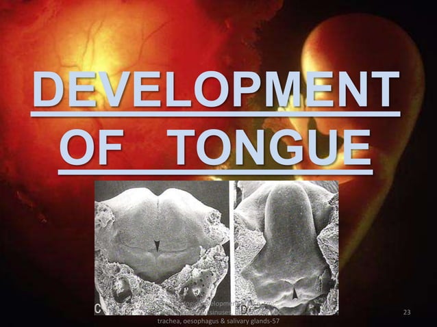 Embryology of face, tmj, tongue, paranasal sinuses, pharynx, larynx ...