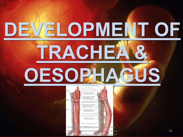 Embryology of face, tmj, tongue, paranasal sinuses, pharynx, larynx ...