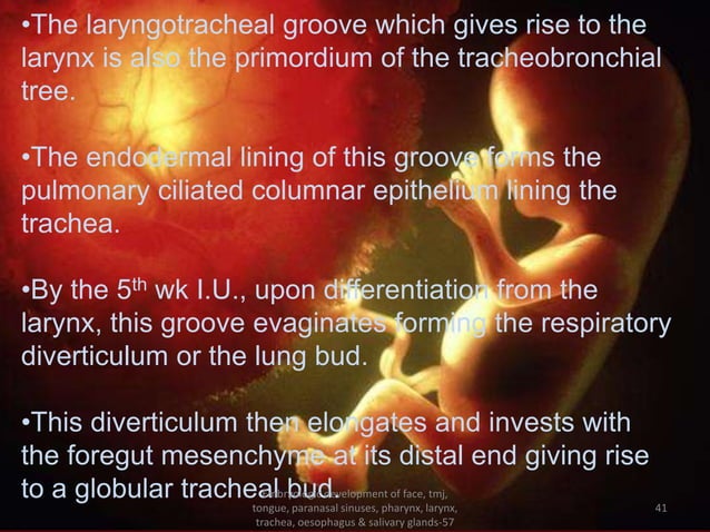 Embryology of face, tmj, tongue, paranasal sinuses, pharynx, larynx ...