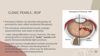 EMBRYOLOGY OF RETINA AND CHOROID . ...... | PPT
