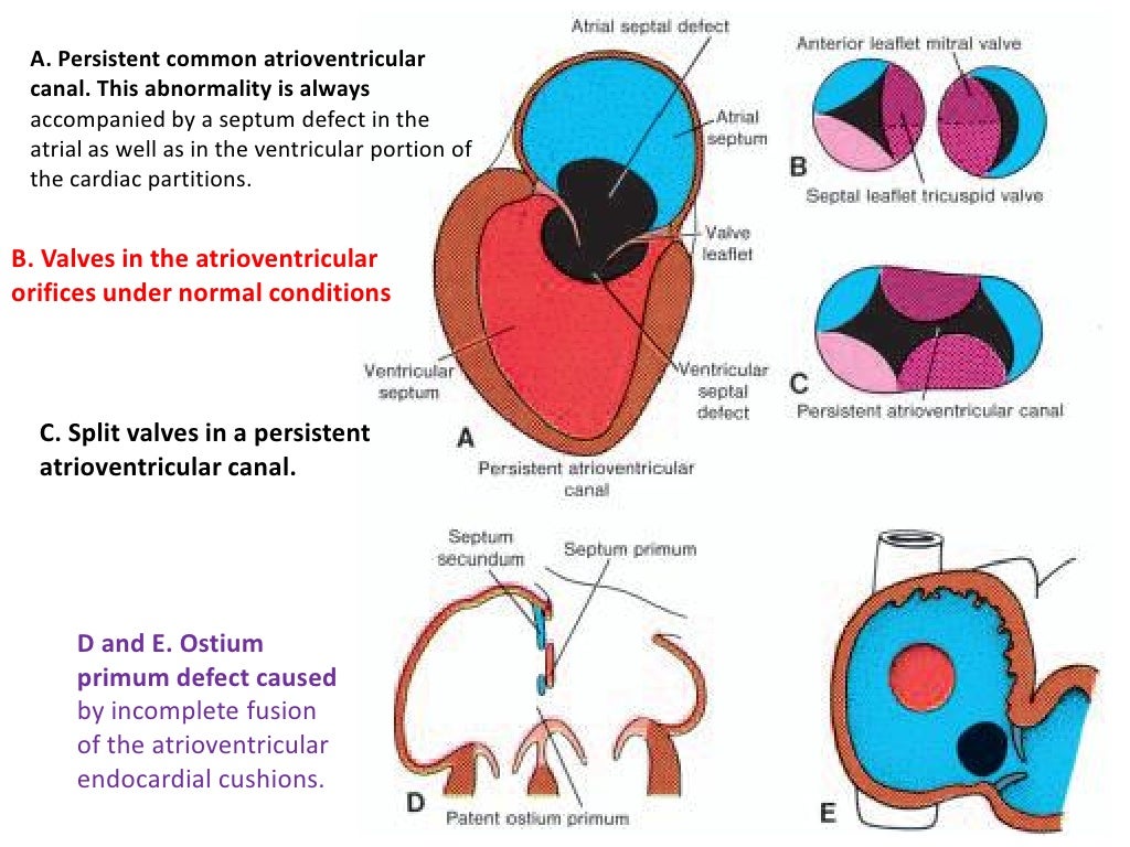 Embryology Of Heart