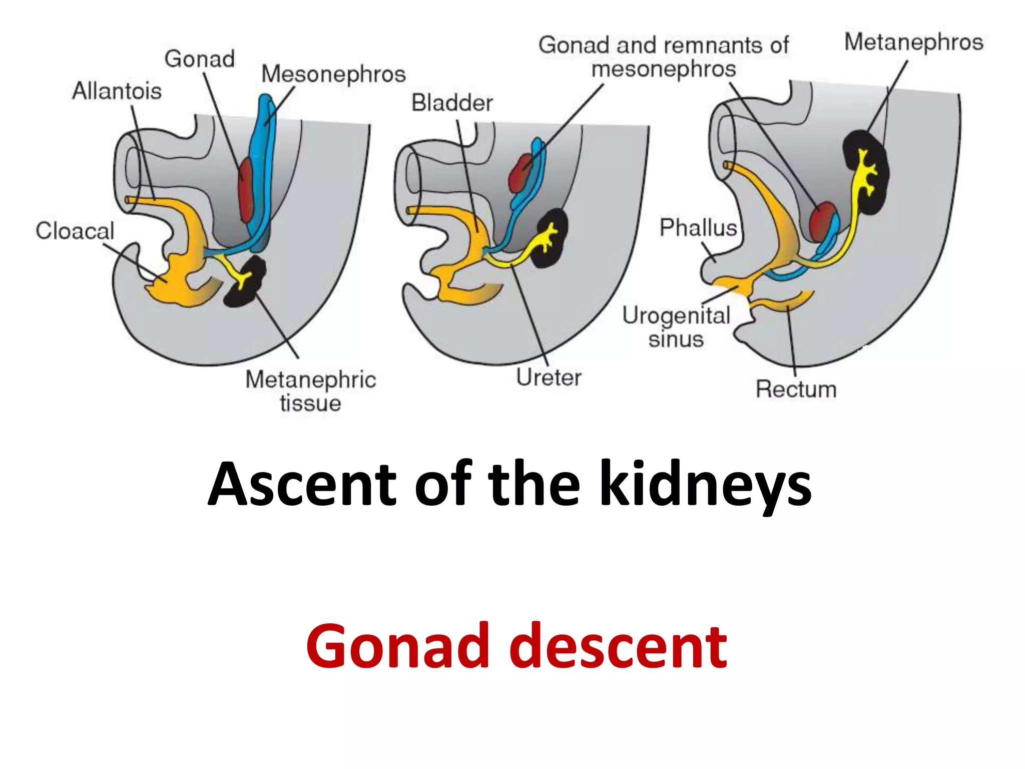 Embryology urogenital system | PPTX | Reproductive Health | Diseases ...