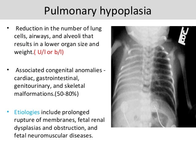 development of lung