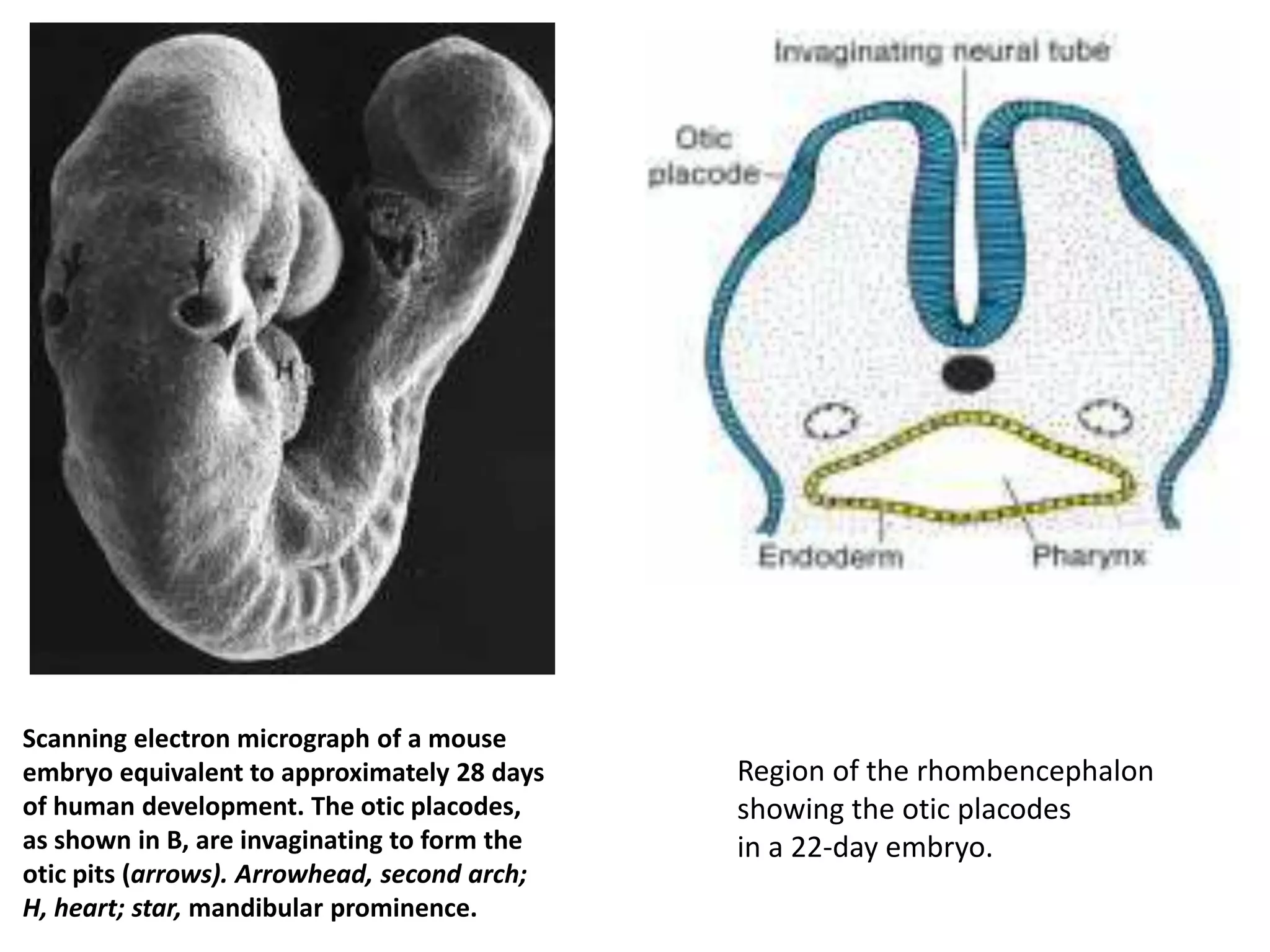 Embryology 18 ear | PPTX